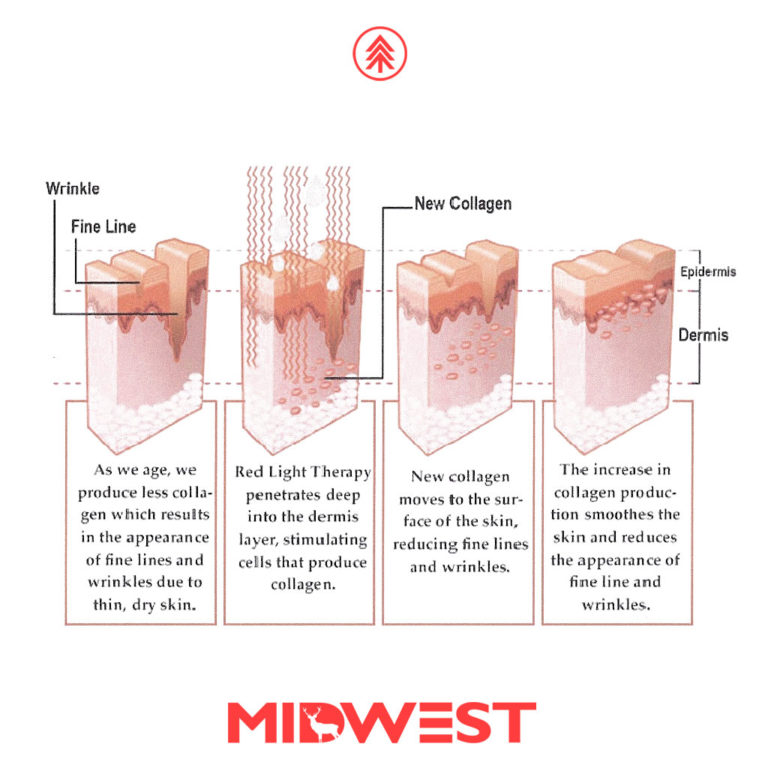 COLLAGEN PRODUCTION – Midwest Red Light Therapy