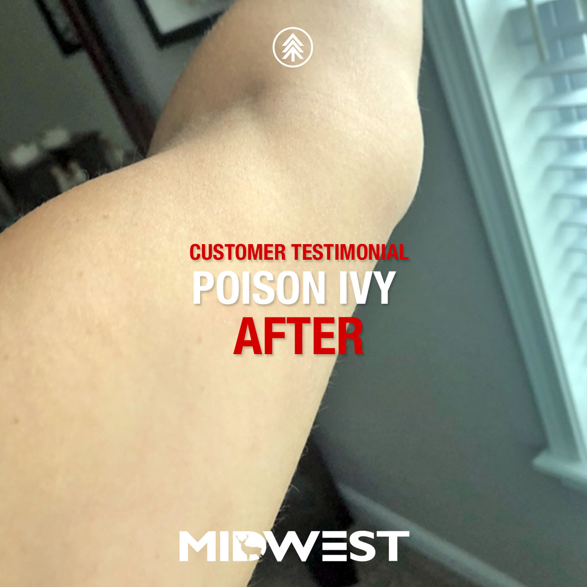 POISON IVY TESTIMONIAL – Midwest Red Light Therapy